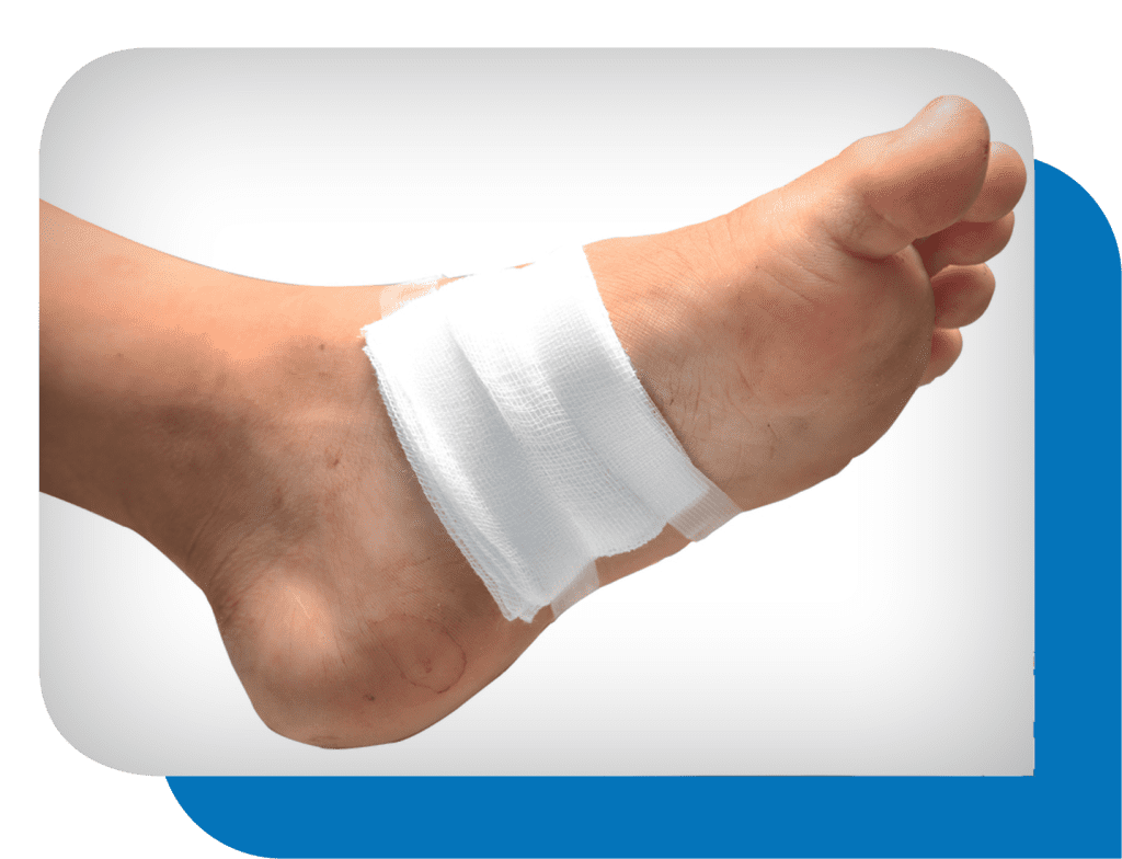 Diabetes Wound Care - CDEM Hospital